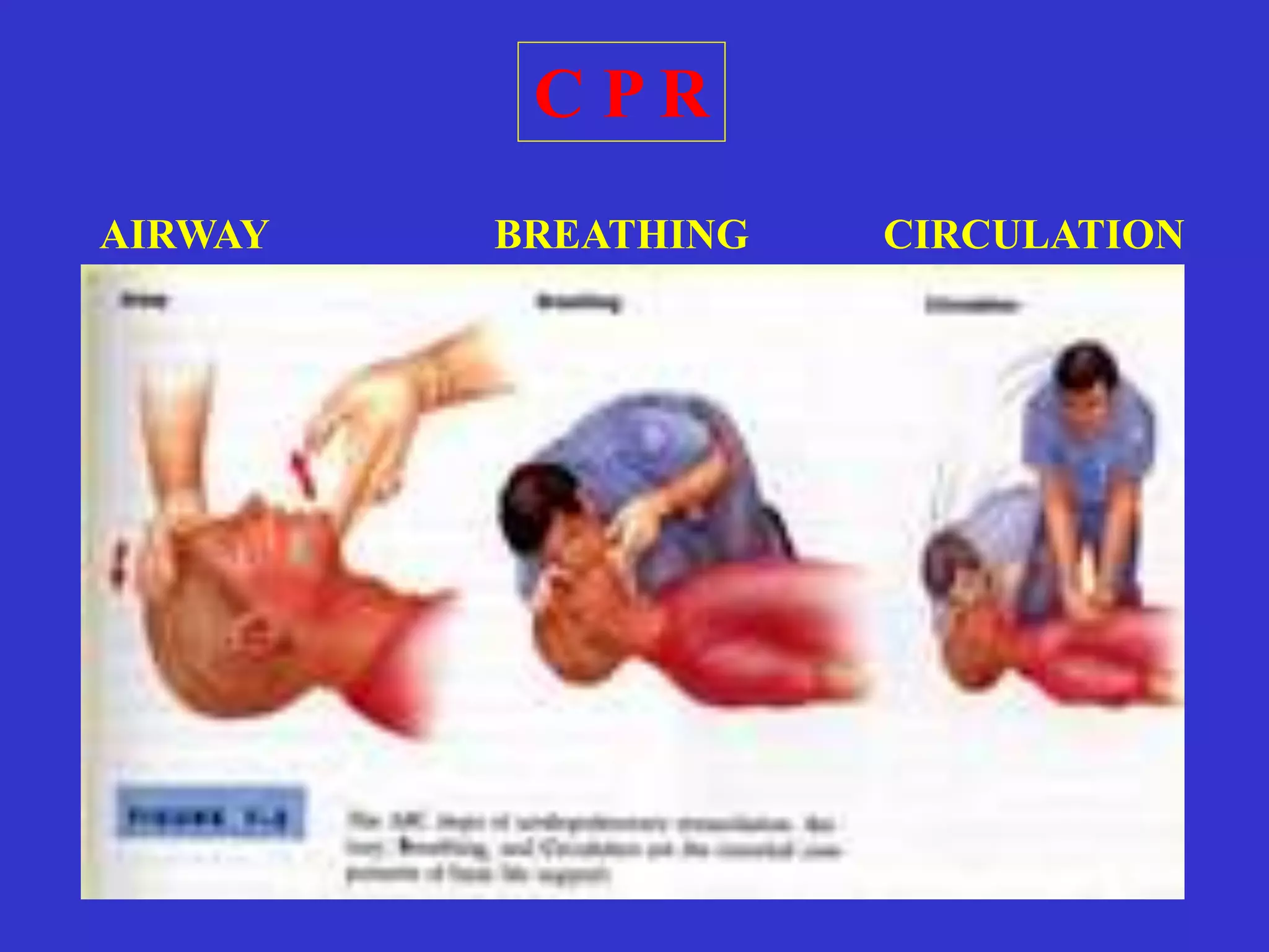 CPR.ppt