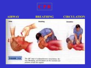 CPR.ppt