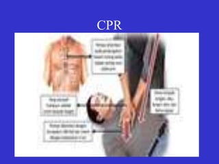 CPR.ppt