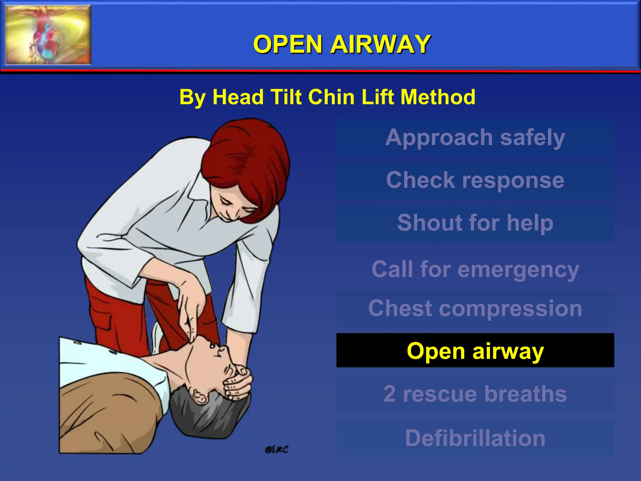CPR ( Cardio Pulmonary Resuscitation ) skill to save lives in cardiac ...