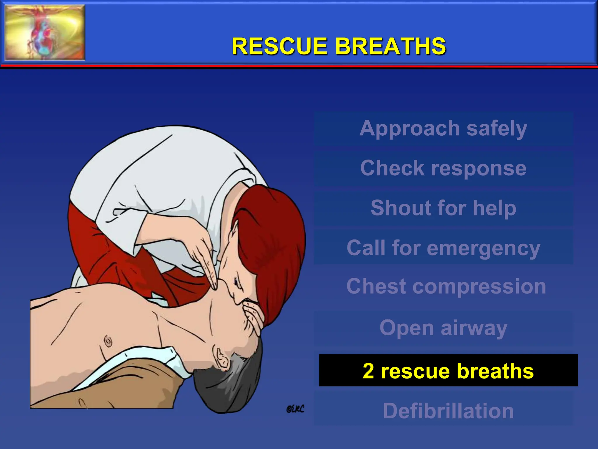 CPR ( Cardio Pulmonary Resuscitation ) skill to save lives in cardiac ...