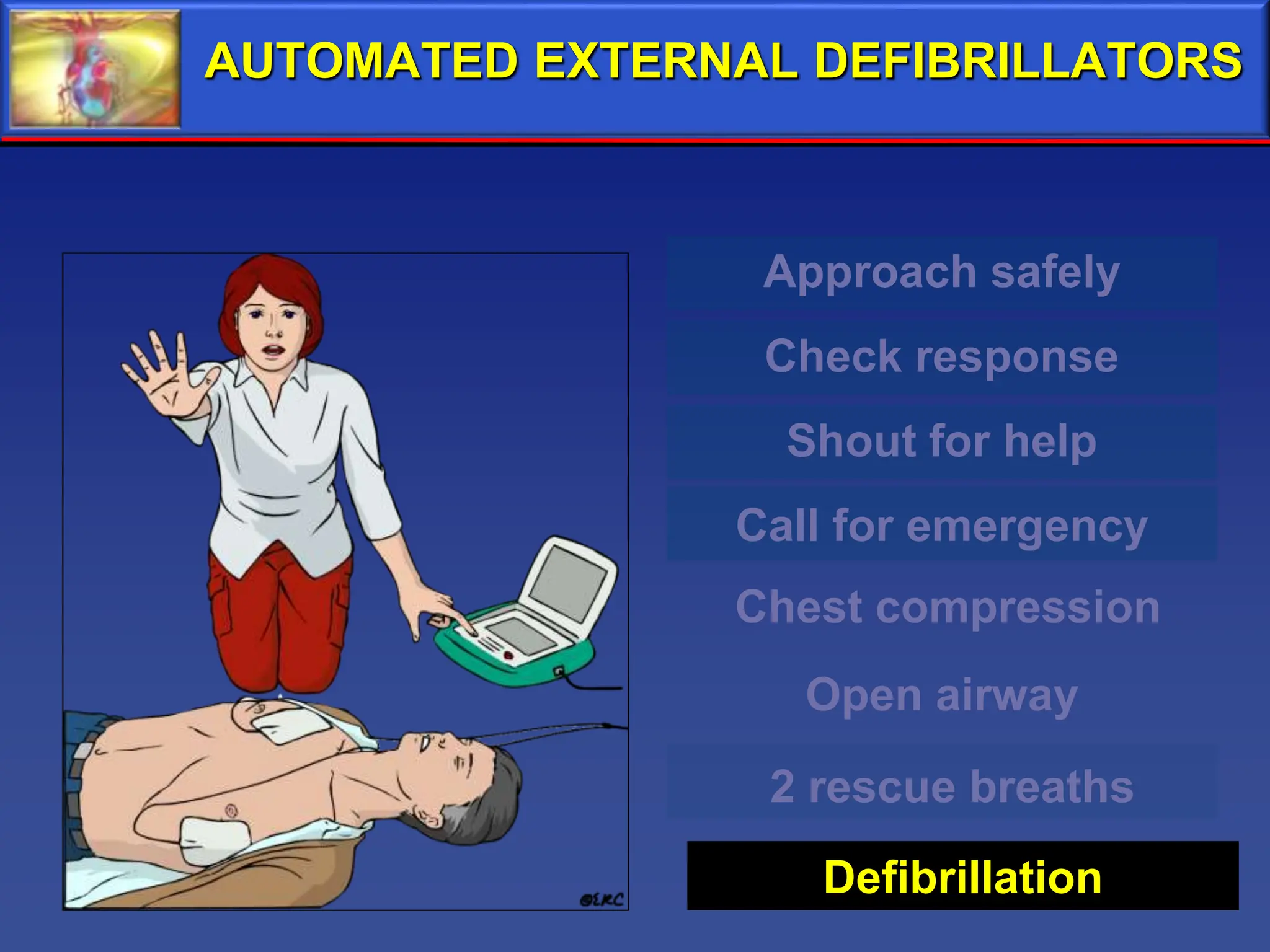 CPR ( Cardio Pulmonary Resuscitation ) skill to save lives in cardiac ...