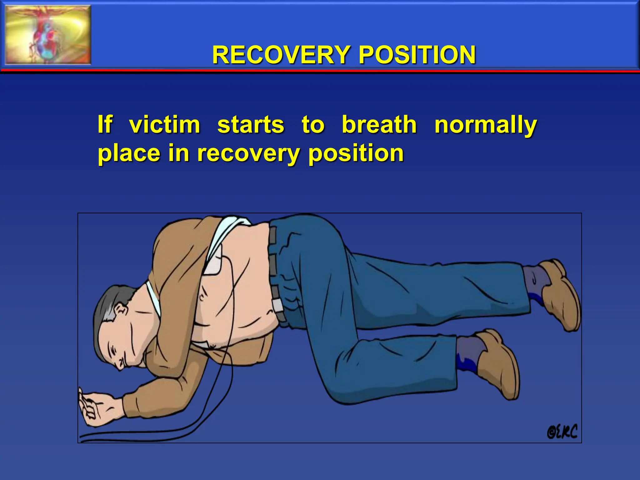 CPR ( Cardio Pulmonary Resuscitation ) skill to save lives in cardiac ...