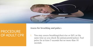 CARDIOPULMONARY RESUSCITATION BY ANUSHRI SRIVASTAVA.pptx