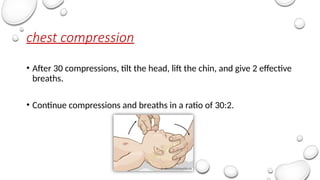 CPR....pptx. . . | PPTX