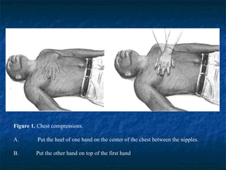 CARDIAC PULMONARY RESUSCITATION POWER POINT | PPT