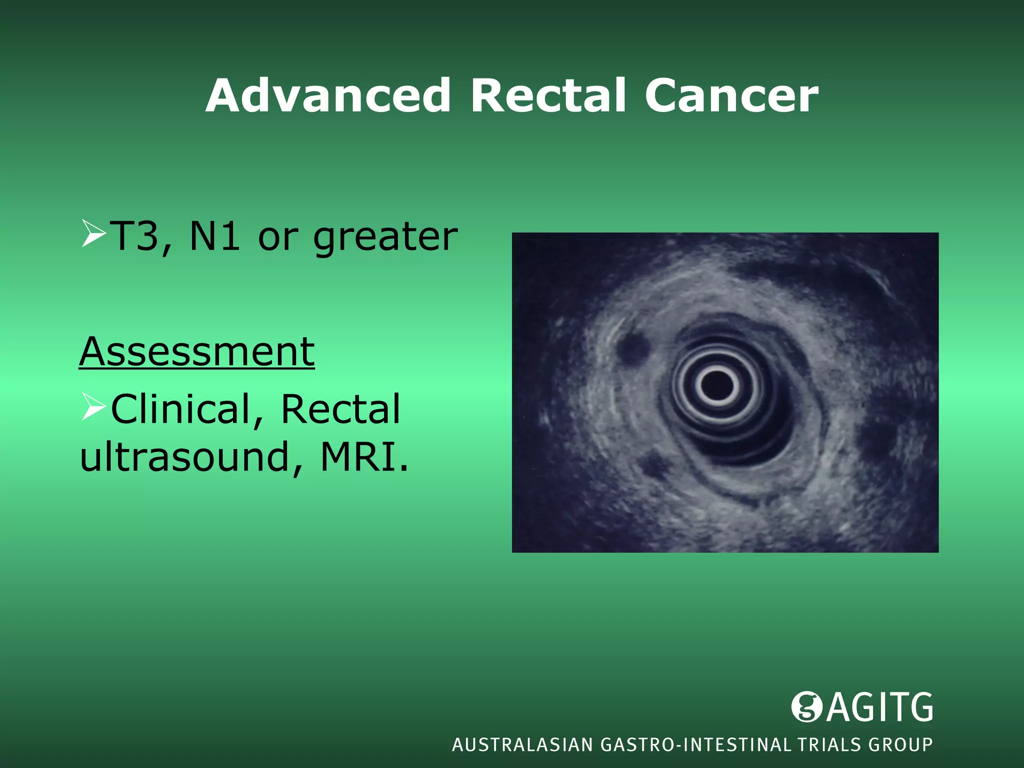 Rectal Cancer and Radiotherapy: What is the Clinical Implication of a ...