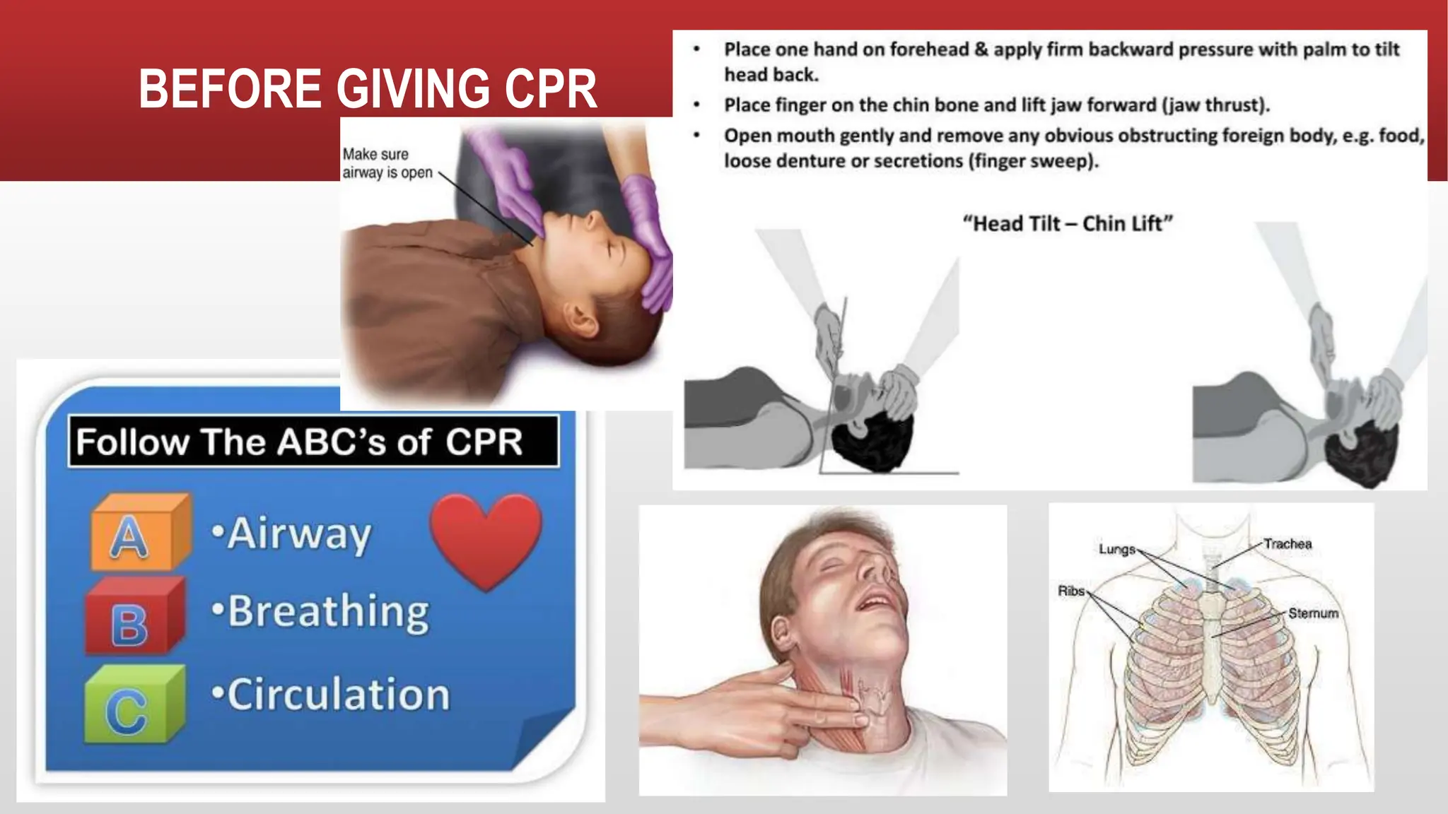 Basic Life Support_Cardiopulmonary Resuscitation | PPT