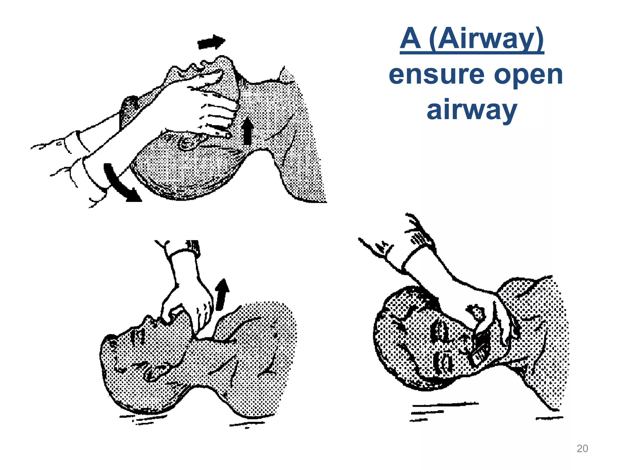 Cpr 2010 | PPT