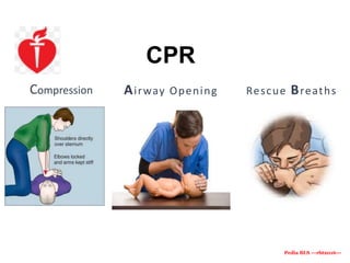 cardiopulmonary resucitation in children | PPT