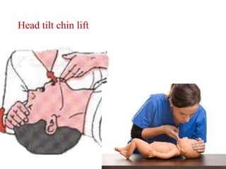 cardiopulmonary resucitation in children | PPT