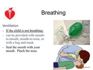 cardiopulmonary resucitation in children | PPT