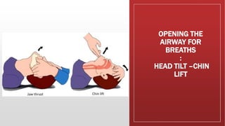 CPR | PPTX