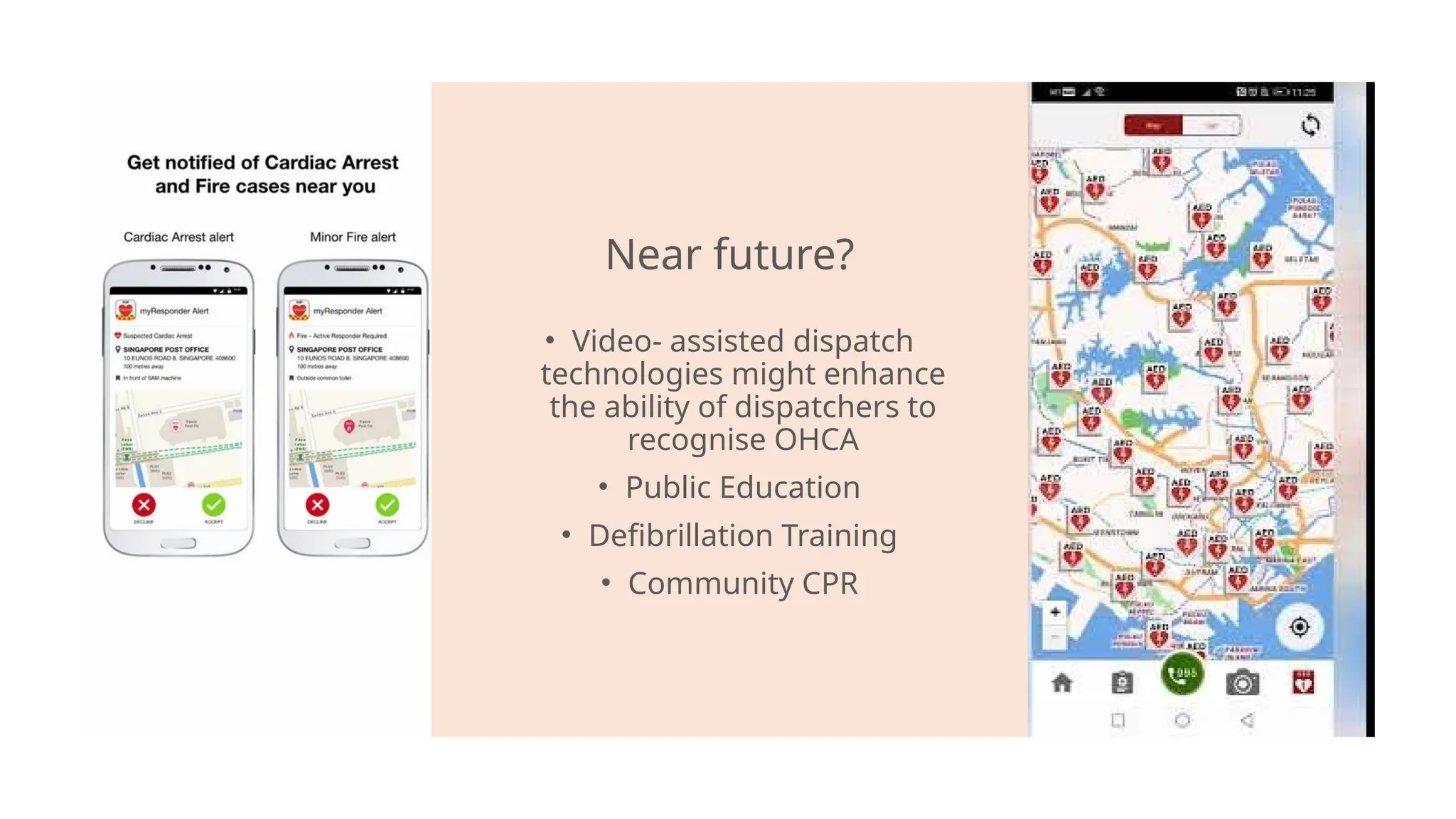 CARDIOPULMUNARY RESISCITATION R and E-CPR (THE ROLE OF ECMO).pptx | Free Download