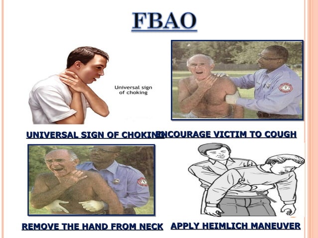 Cpr and fbao | PPT | First Aid | Injuries
