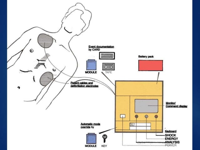 BASIC LIFE SUPPORT- BLS (CPR) -American Heart Association | PPT | First ...