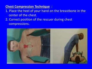BASIC LIFE SUPPORT | PPT