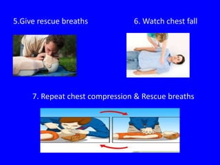 BASIC LIFE SUPPORT | PPT