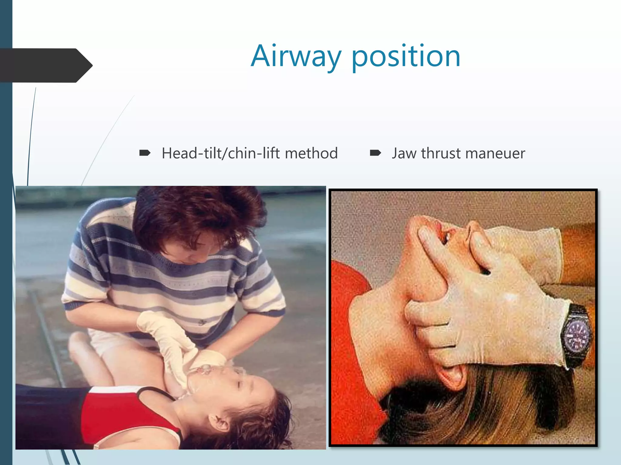 CPR- Cardio Pulmonary Resusciatation (Pediatrics) | PPTX