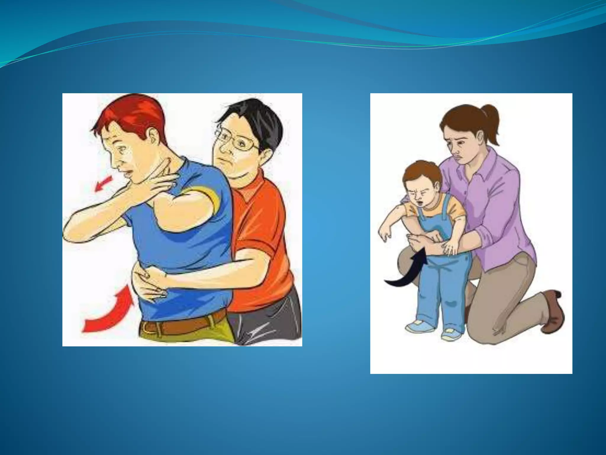 Cpr, choking, bleeding emergencies | PPTX