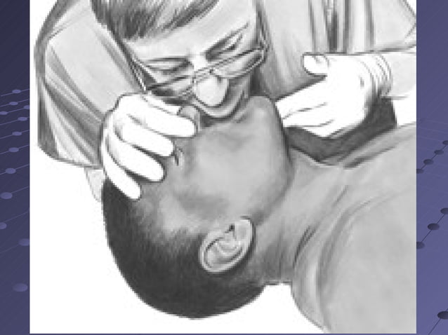 CPR( Cardiopulmonary Resuscitation | PPT | First Aid | Injuries