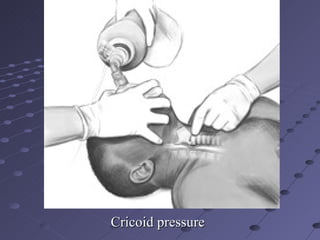 CPR( Cardiopulmonary Resuscitation | PPT