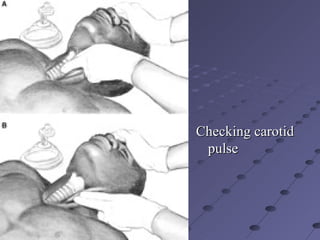 CPR( Cardiopulmonary Resuscitation | PPT