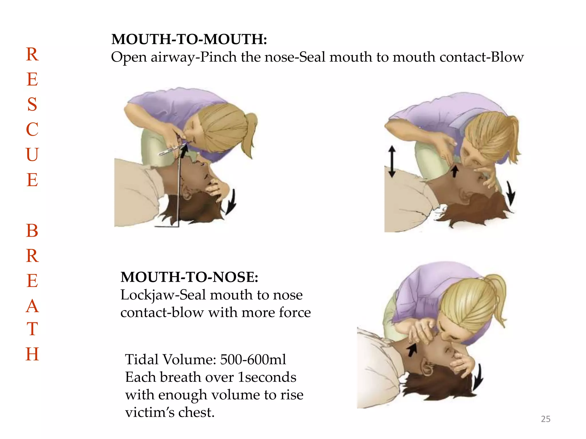 CARDIOPULMONARY RESUSCITATION- BLS & ACLS-2020 AHA UPDATE | PPT