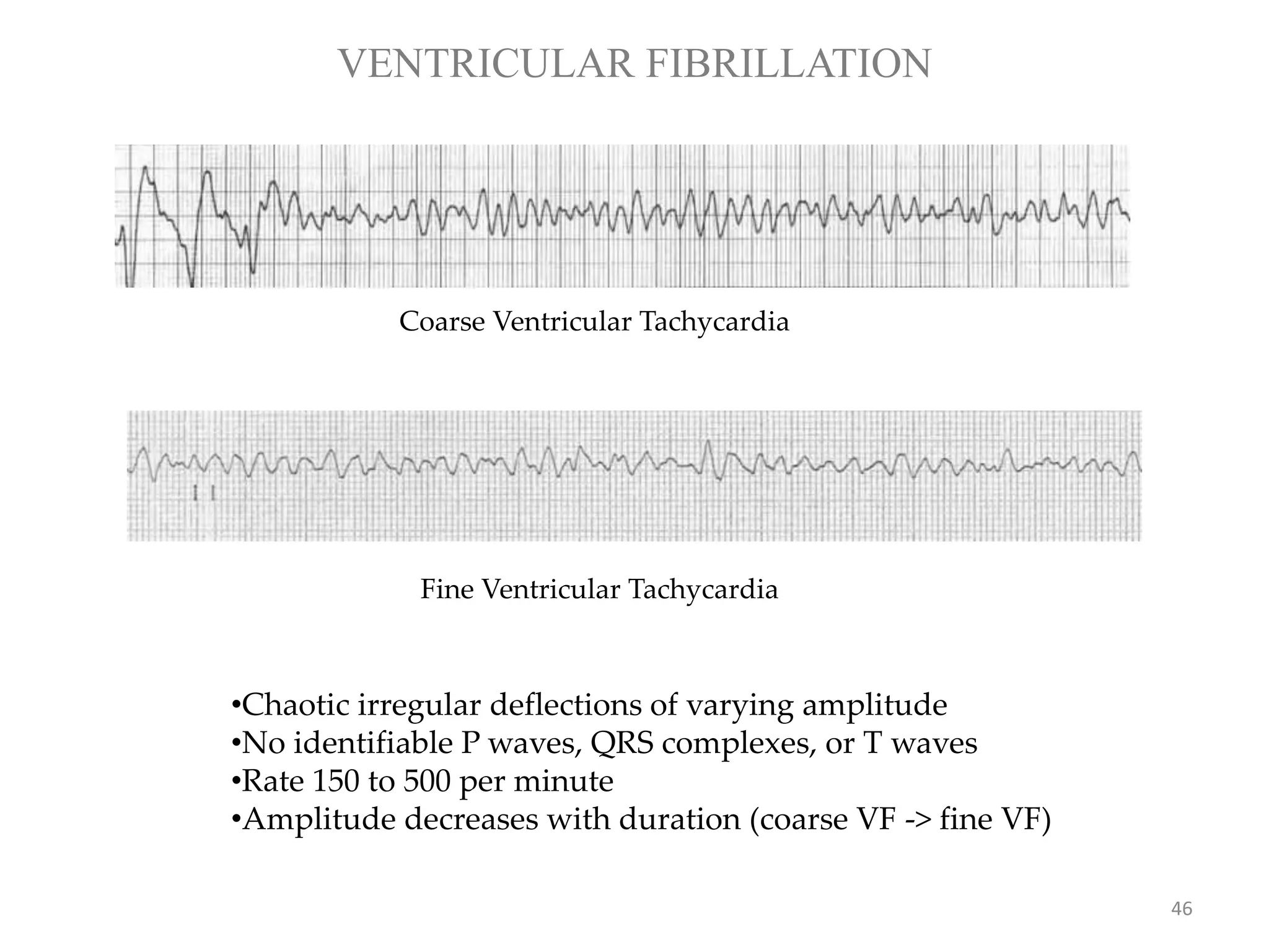 CPR: CARDIOPULMONARY RESUSCITATION- BLS & ACLS-2020 AHA UPDATE | PPTX ...