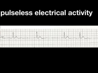 CPR in the Hospital Environment | PPT