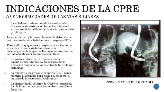 COLANGIOPANCREATROGRAFÍA RETRÓGRADA ENDOSCÓPICA - CPRE