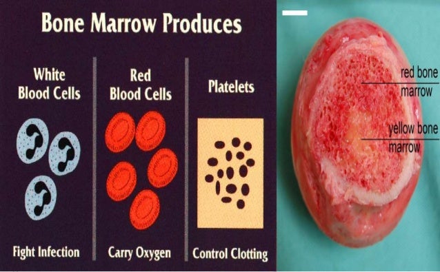 Case Presentation on Methotrexate Induced bone marrow suppression