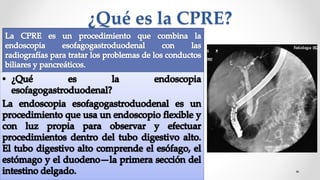 Colangiopancreatografía Retrógrada Endoscópica