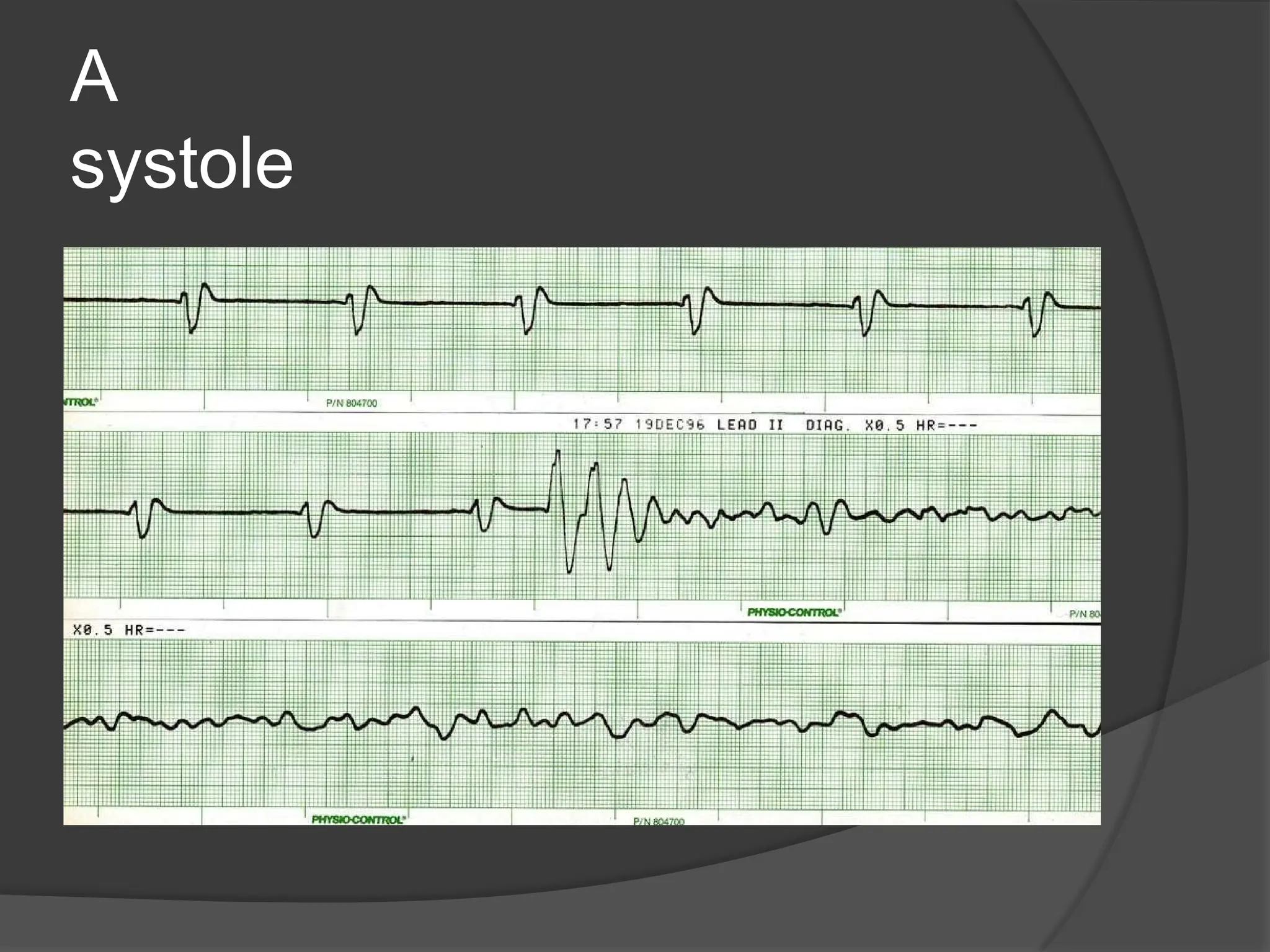 Procedure of providing cardio pulmonary resuscitation | PPT