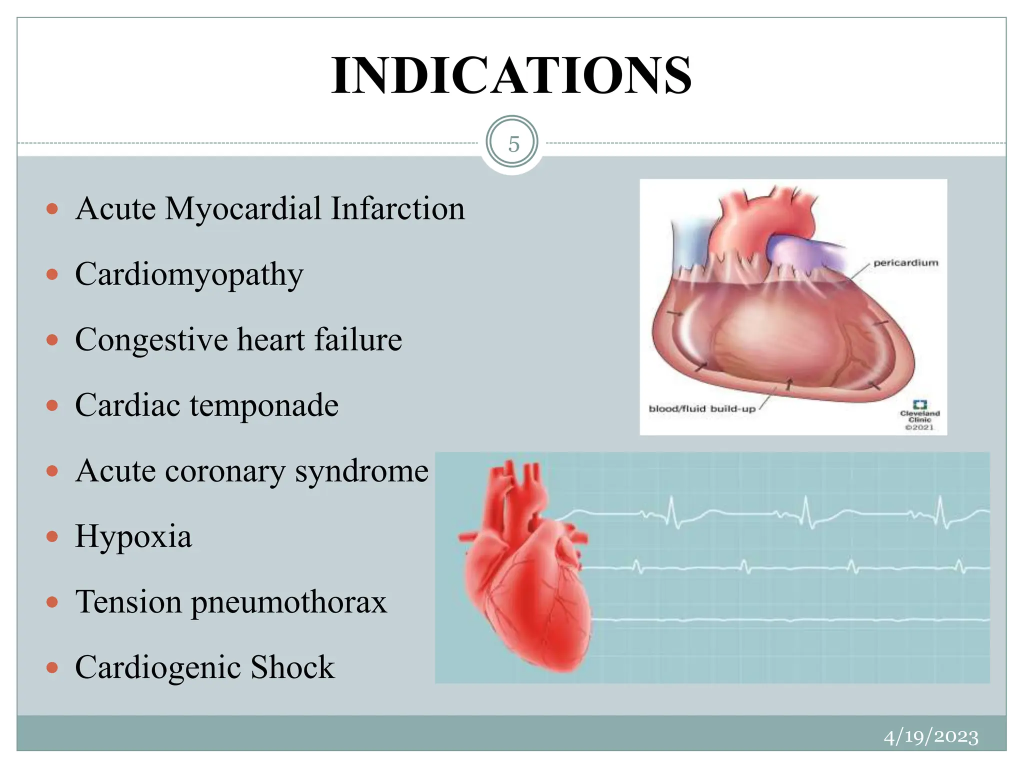 Cardiopulmonary resuscitation ppt.pptx
