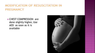 Cpr guideline in pregnacy | PPTX