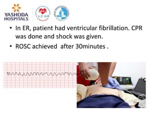 CPR IN INDIA –.pptx