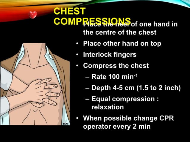 Cardiopulmonary Resuscitation (CPR) | PPT