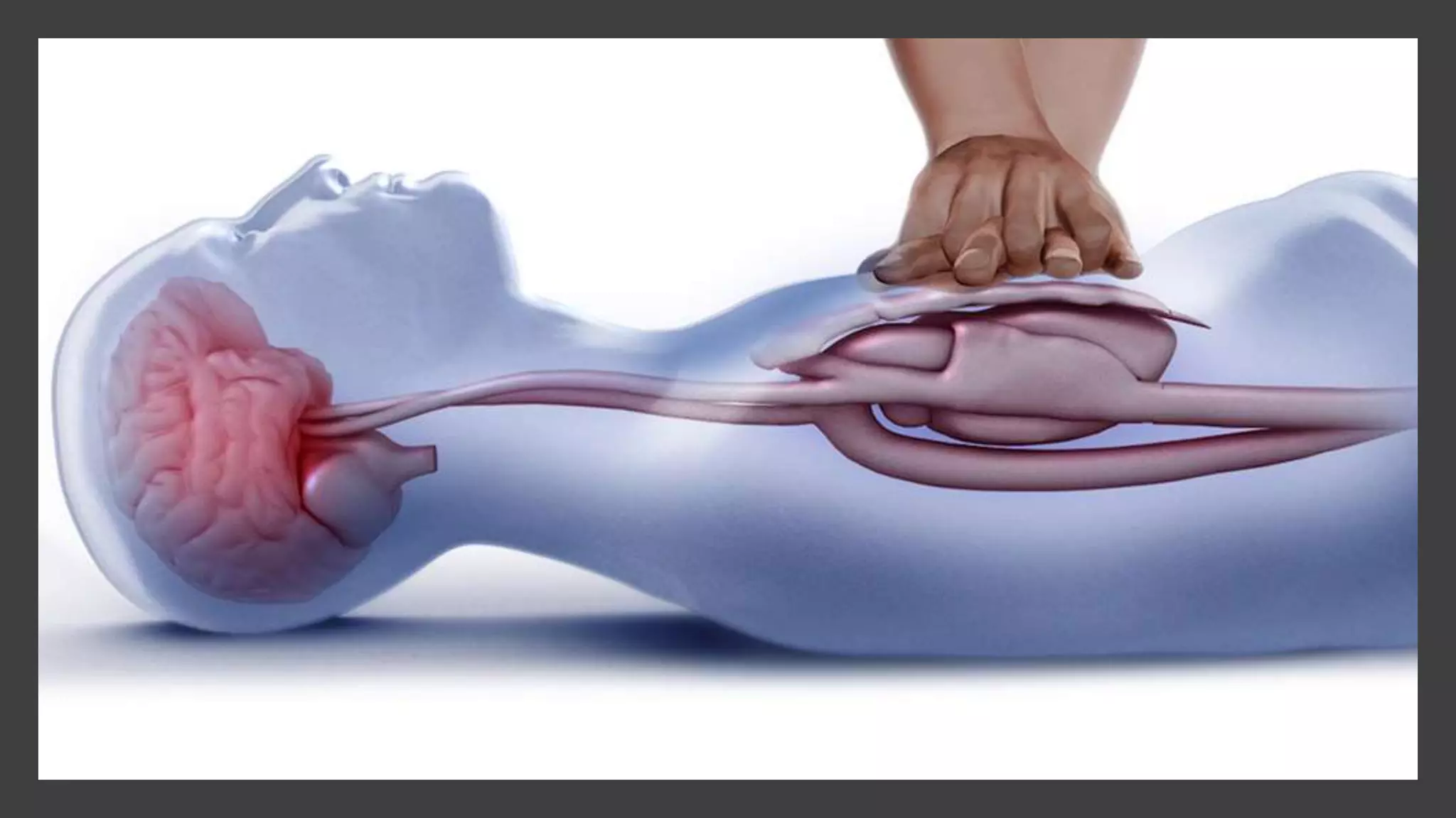 BASIC LIFE SUPPORT | PPT