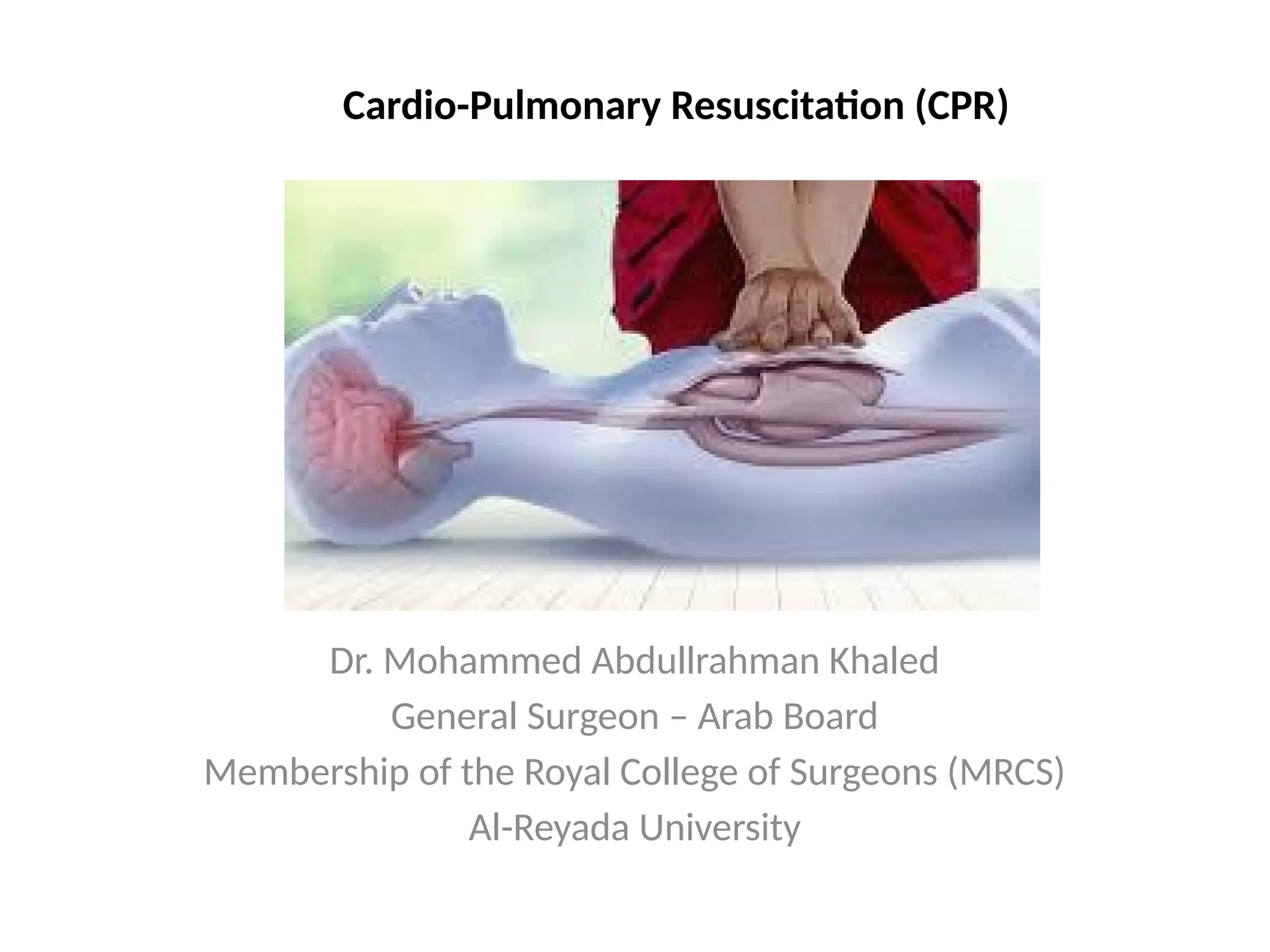 CPR_LCPR steps , technique , diagnosis of CP arrest , drugs, airwayDr ...