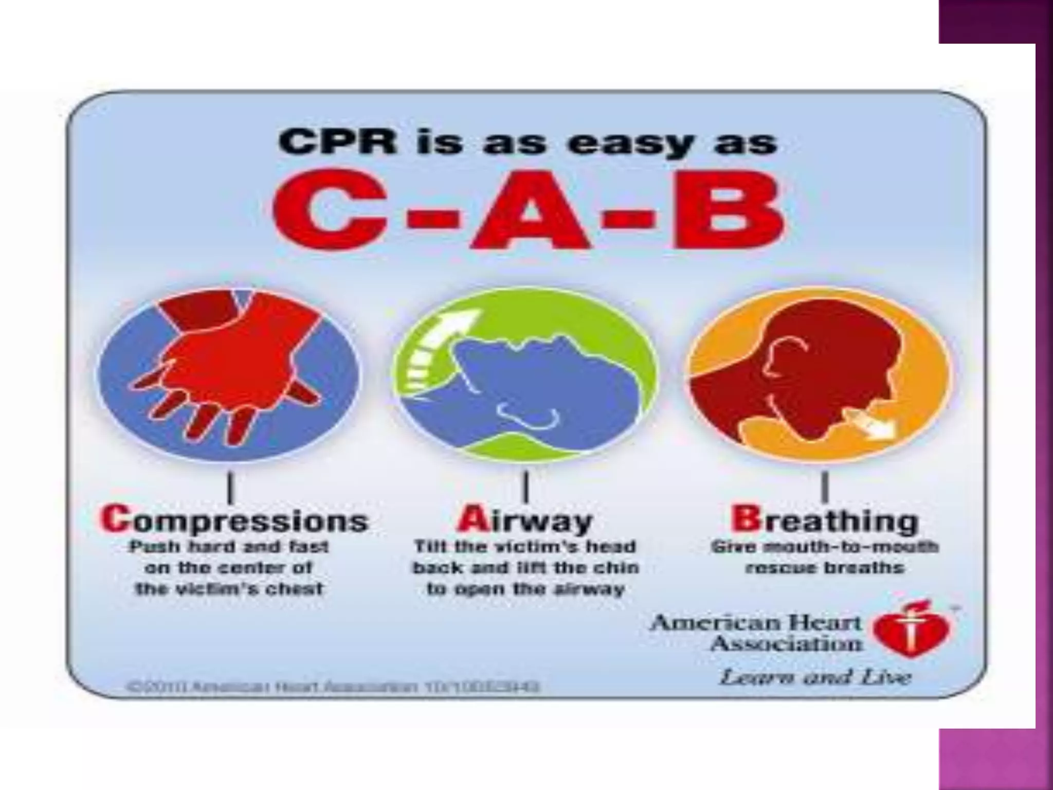 Cpr management | PPTX