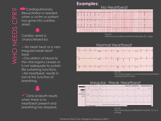 CPR PP | PPTX