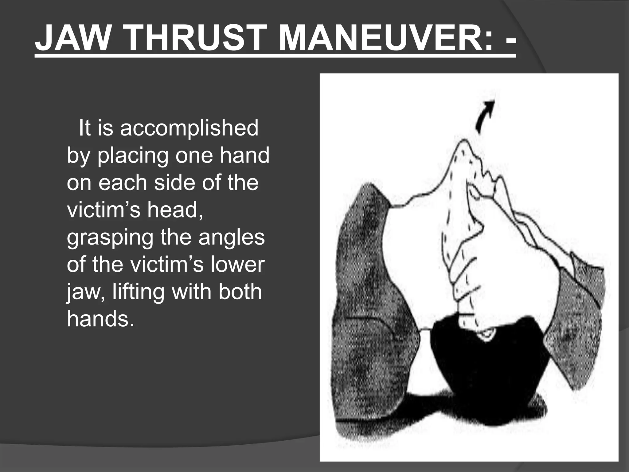 Cpr ppt | PPTX