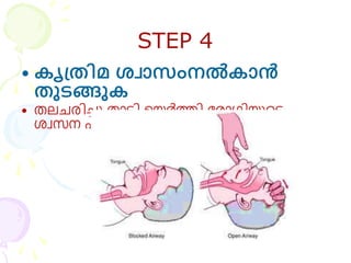 CPR COLS Describing about Describing about COLS and Cardiac arrest ...