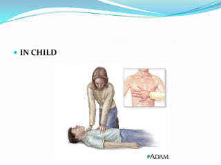 Cpr ppt | PPTX