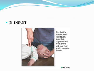 Cpr ppt | PPTX