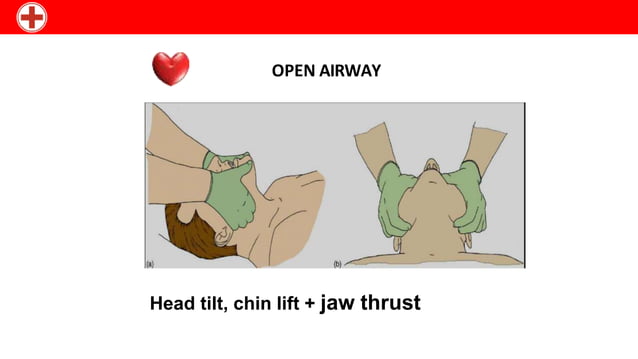 CPR Template lab.pptx