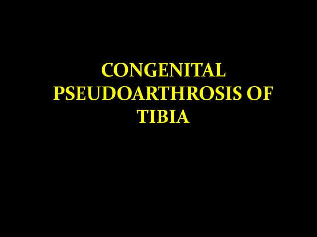 Congenital pseudoarthrosis the of tibia | PPT