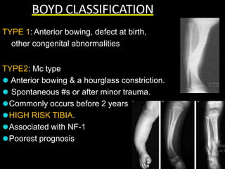 Congenital pseudoarthrosis the of tibia | PPTX