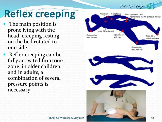 Bottom Up Approaches in children with Cerebral Palsy